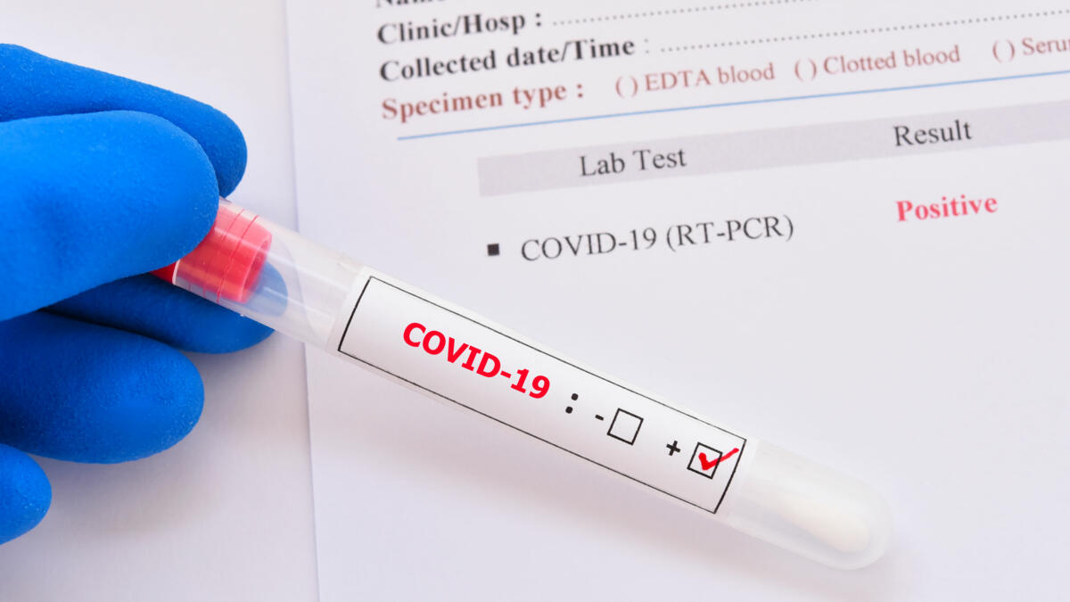 Faux PCR : les sanctions tombent - République Togolaise