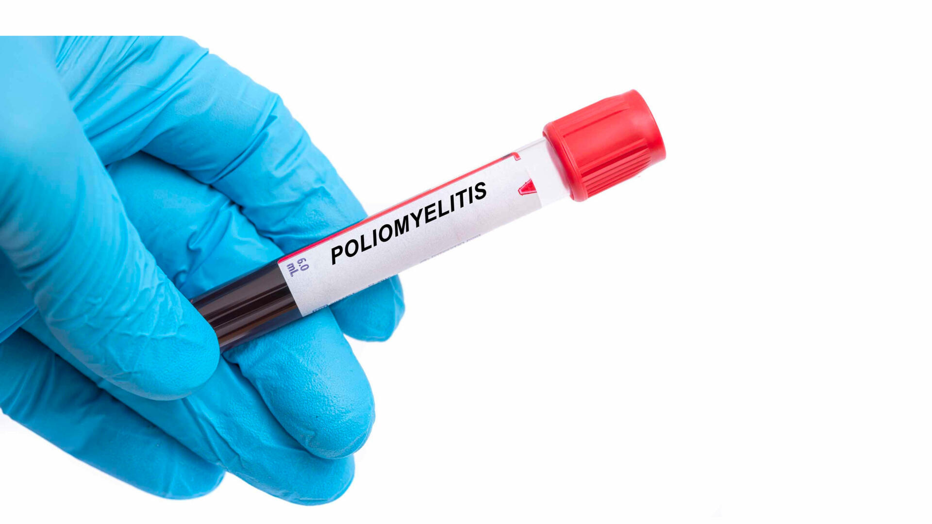 Eradiquer la polio, c'est possible - République Togolaise