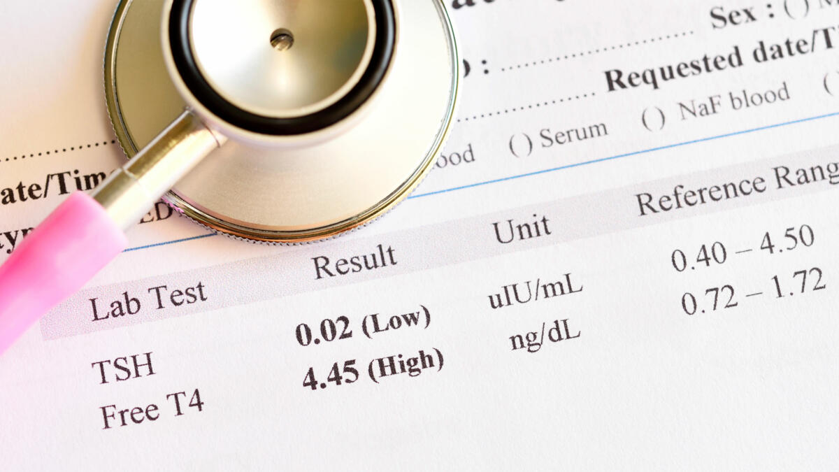 Prevention and Early Detection of Goiter and Thyroid Cancer: Essential ...